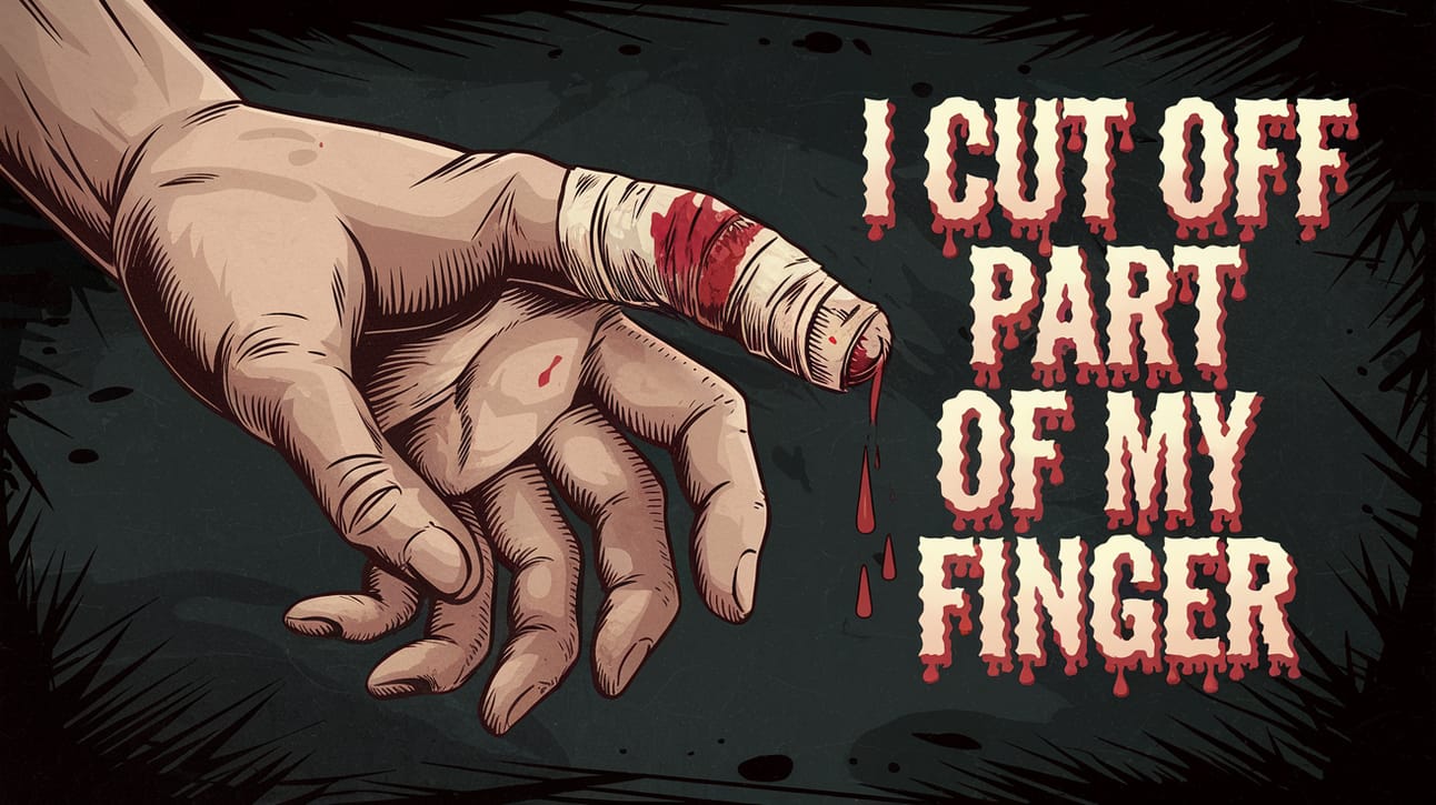 I cut off part of my finger